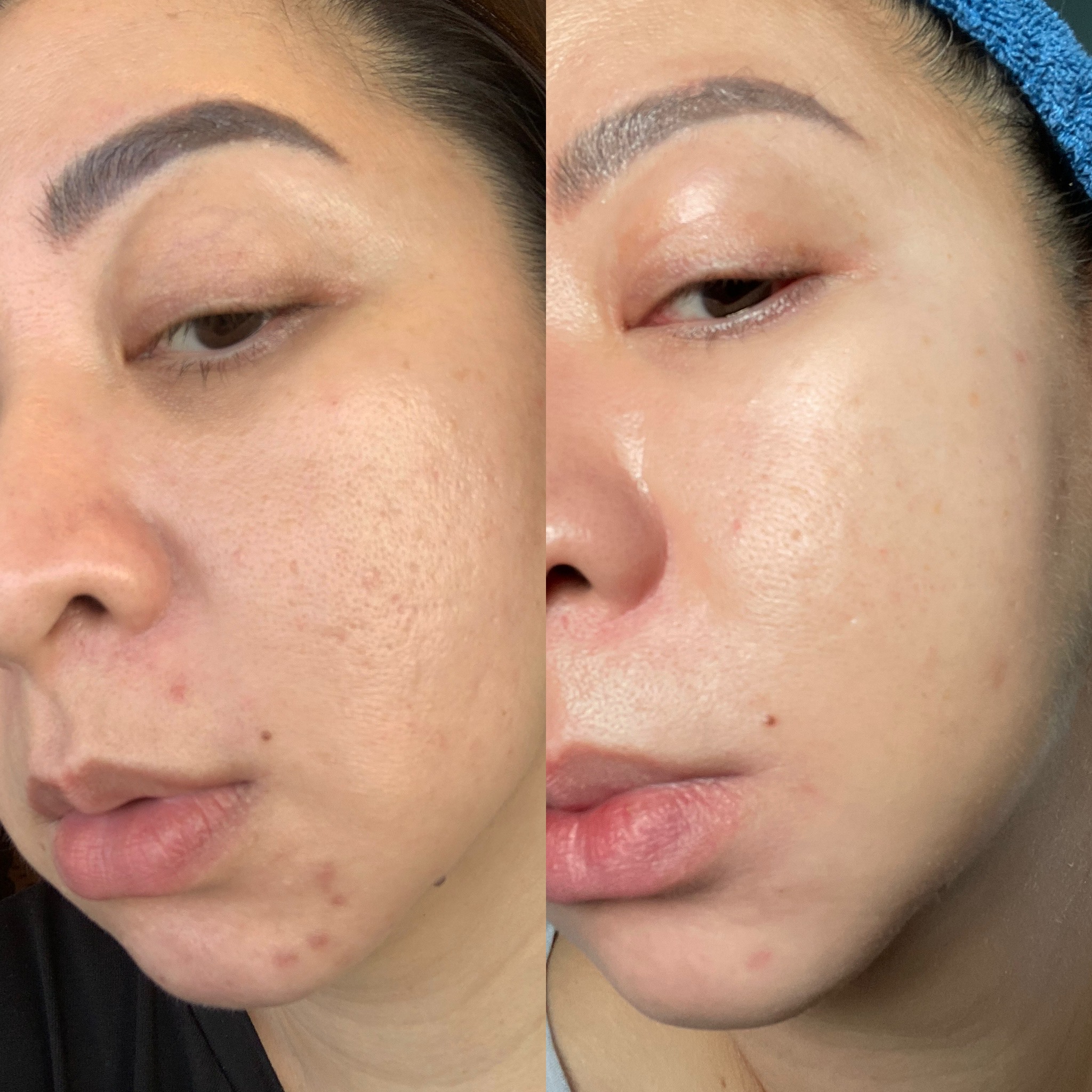Shiny Skin Without Makeup - Infoupdate.org